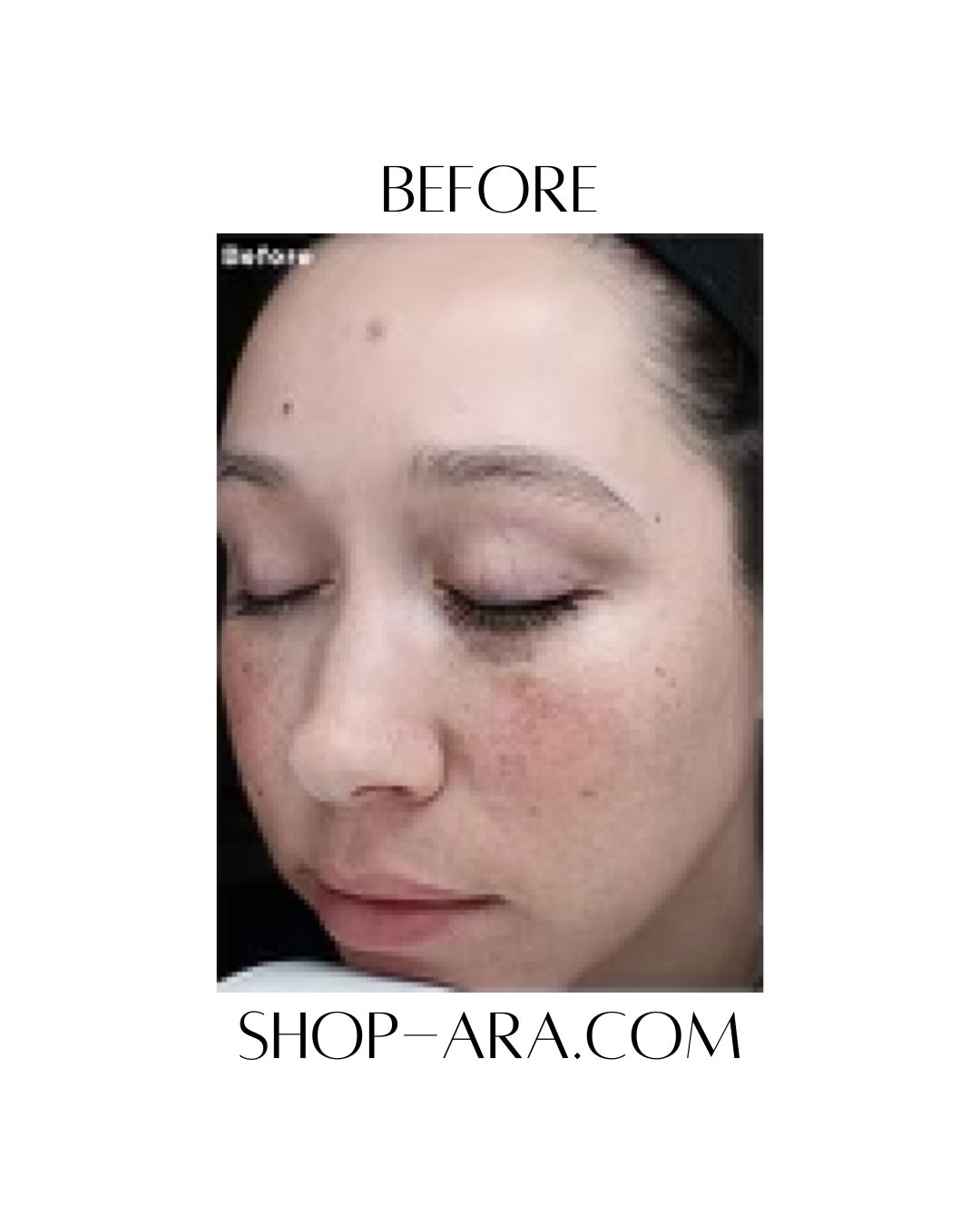 VI Peel Original Kit, VI peel for sale, VI peel at home – shop-ara.com